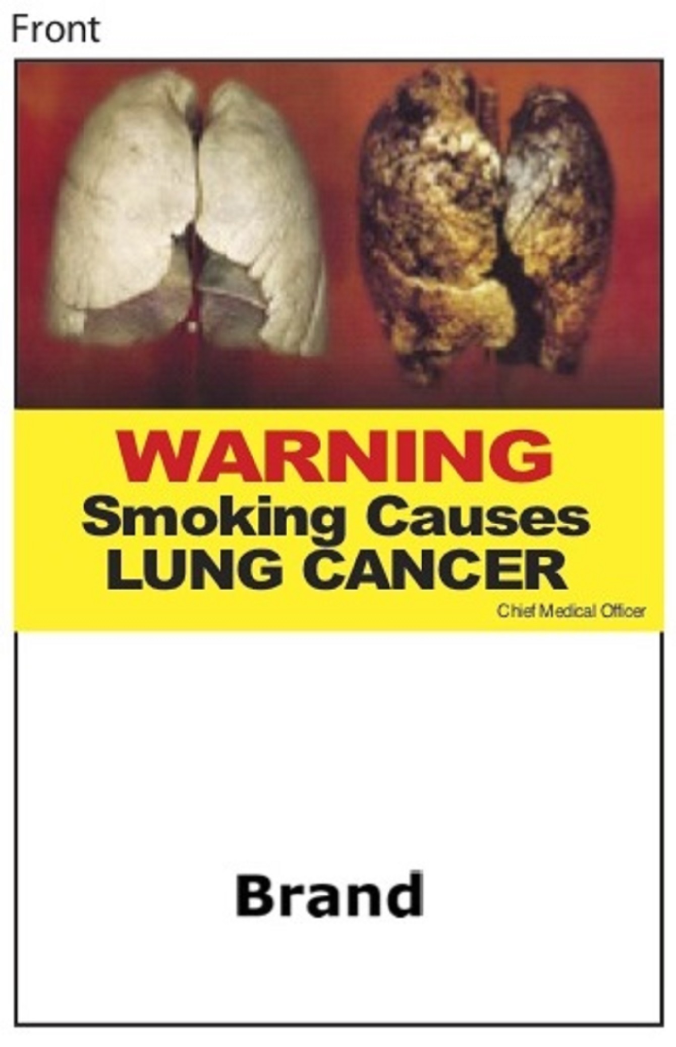 Smoking Causes Lung Cancer Jamaica
