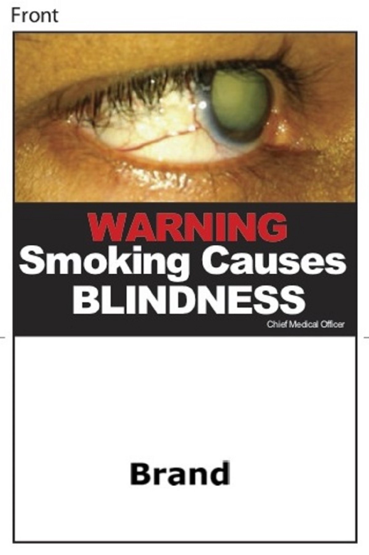 Smoking causes blindness - Jamaica image 2