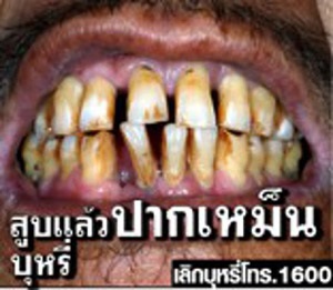 Smoking Causes Your Breath to Smell - Image 2