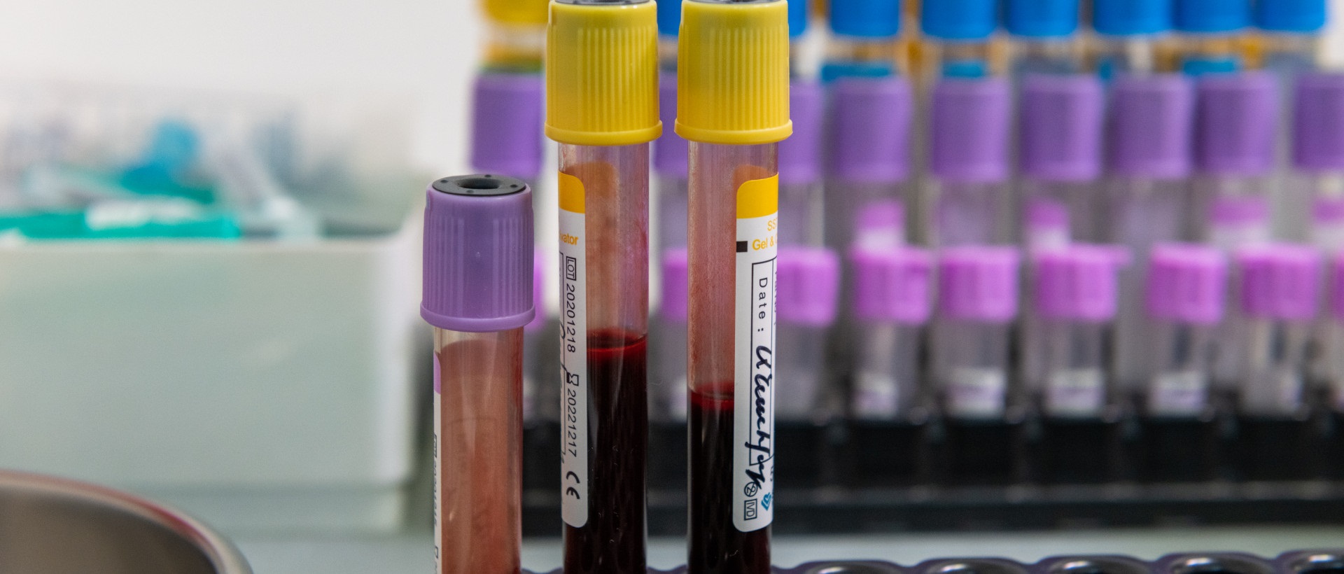 EHP Partnership on Human Biomonitoring