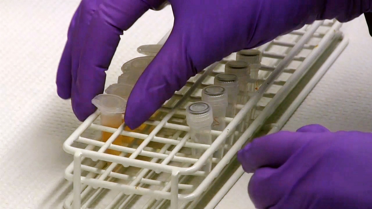 Polio Laboratory Network